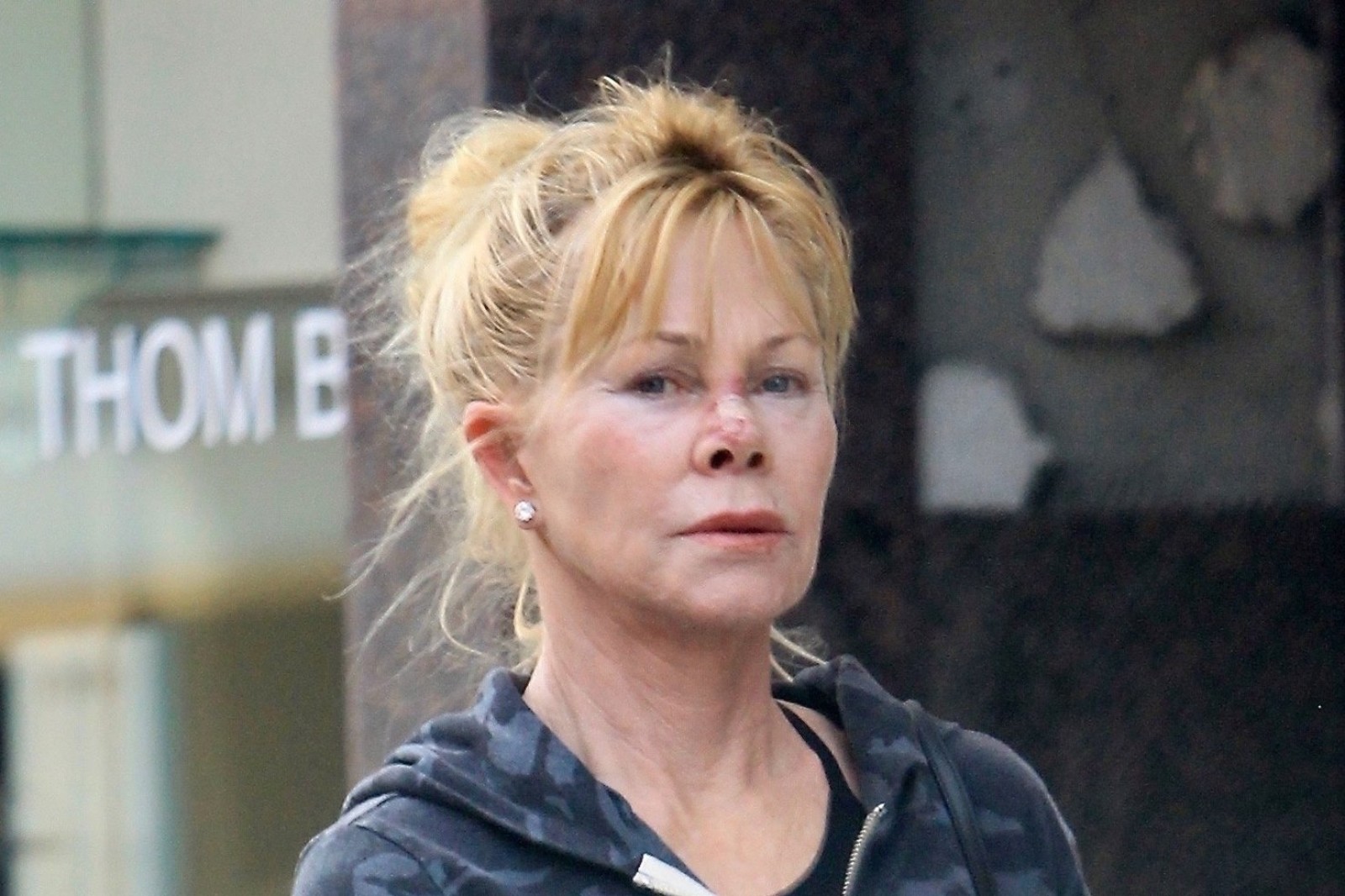 Melanie Griffith: Borba s rakom se nastavlja