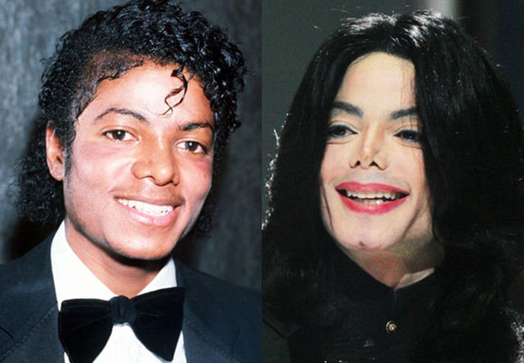 Legendarni Michael Jackson: Umro je usamljen na vrhu i izobličen od ...